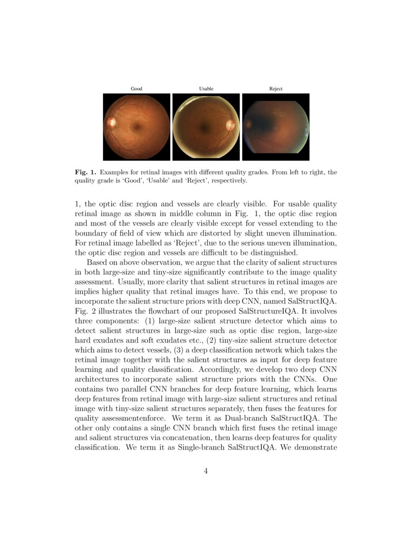 A Deep Retinal Image Quality Assessment Network with Salient Structure ...