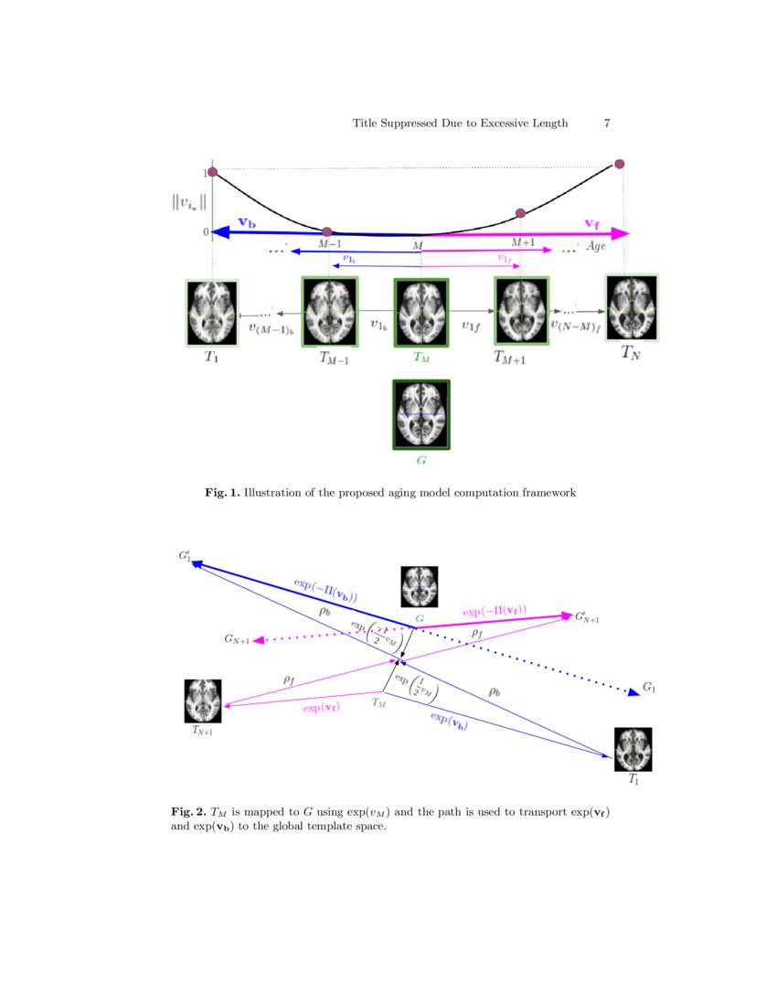 A Diffeomorphic Aging Model for Adult Human Brain from Cross-Sectional ...