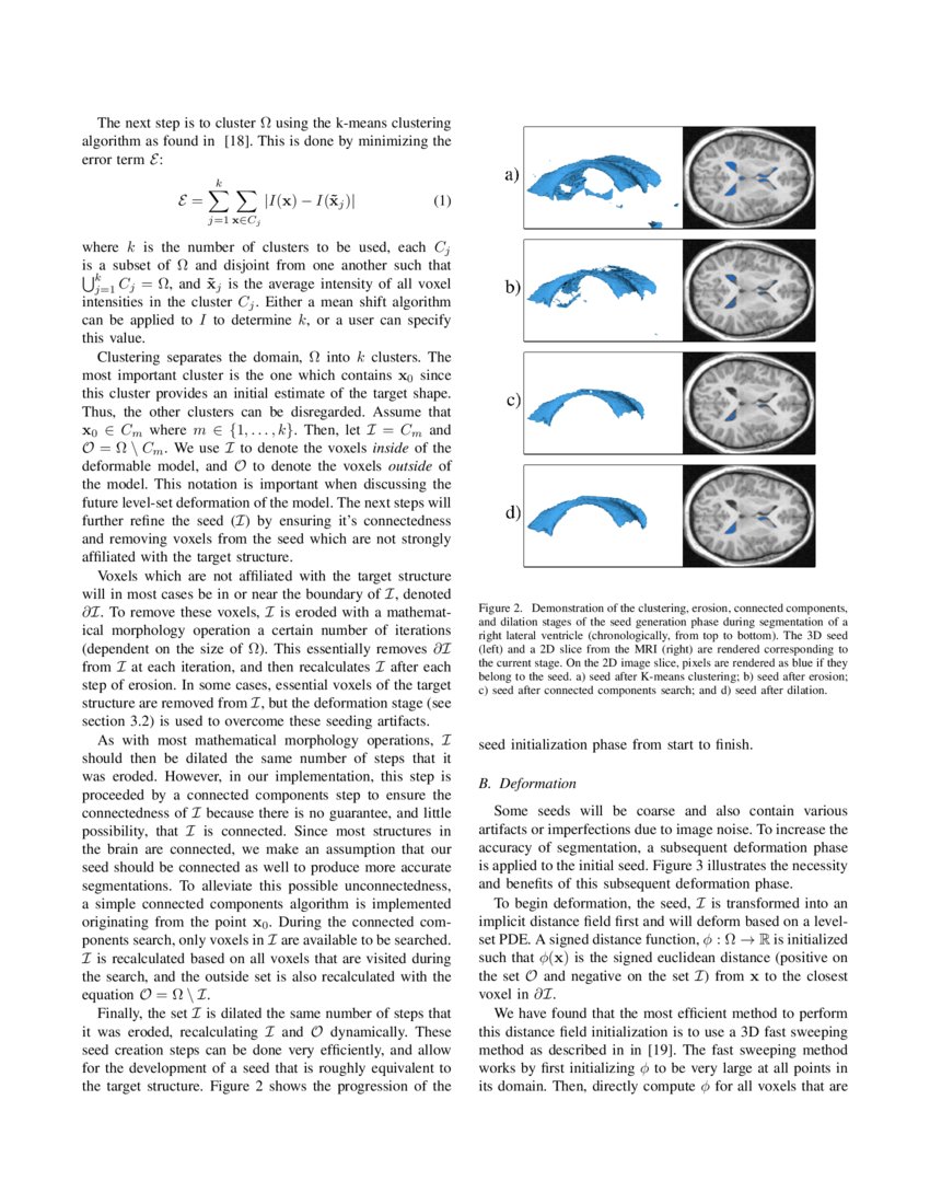 A Fast, Semi-Automatic Brain Structure Segmentation Algorithm for Magnetic Resonance Imaging ...
