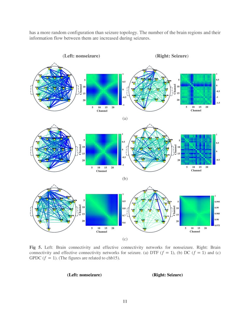 A Framework For Seizure Detection Using Effective Connectivity Graph Theory And Deep Modular