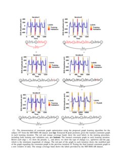 A Graph-Constrained Changepoint Learning Approach for Automatic QRS-Complex Detection | DeepAI