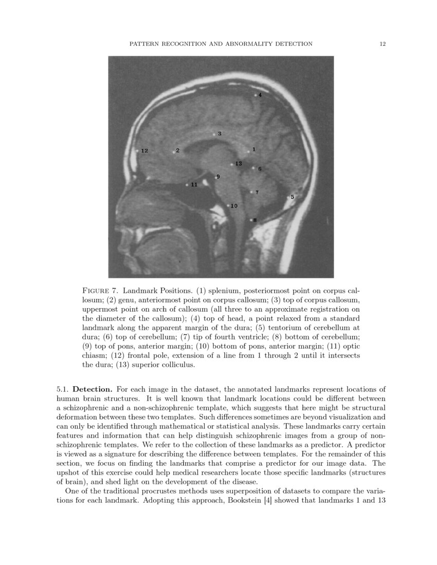 A Landmark Based Algorithm For Automatic Pattern Recognition And