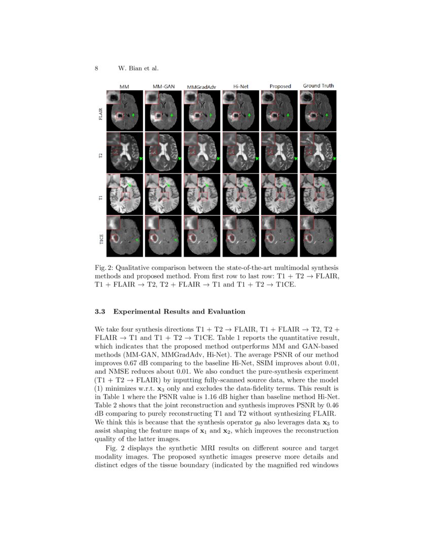 A Learnable Variational Model for Joint Multimodal MRI Reconstruction and Synthesis | DeepAI