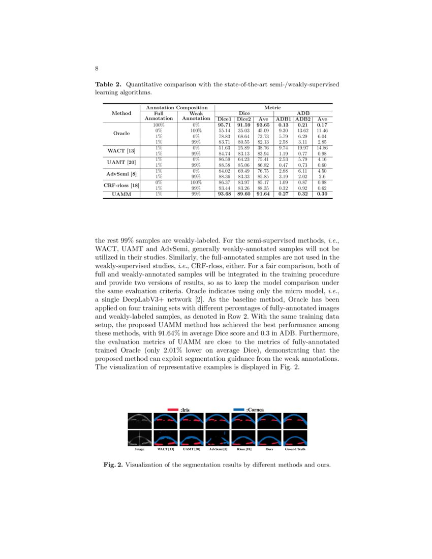 A Macro-Micro Weakly-supervised Framework for AS-OCT Tissue ... A Macro-Micro Weakly-supervised Framework for AS-OCT Tissue ...