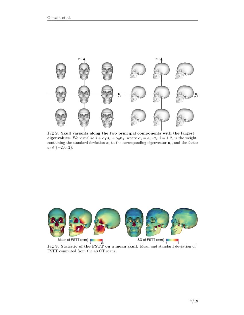 A Method For Automatic Forensic Facial Reconstruction Based On Dense