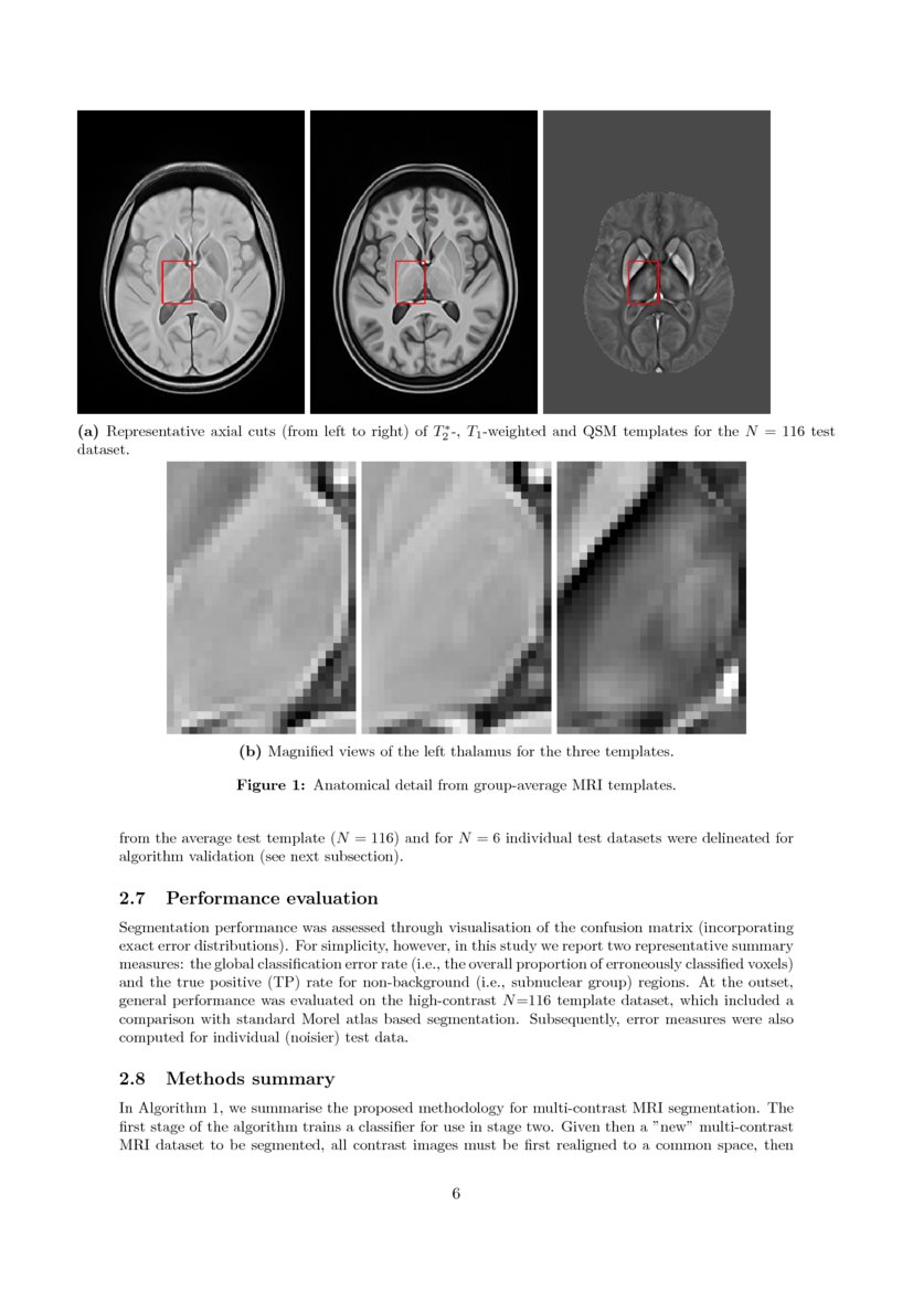A multi-contrast MRI approach to thalamus segmentation | DeepAI