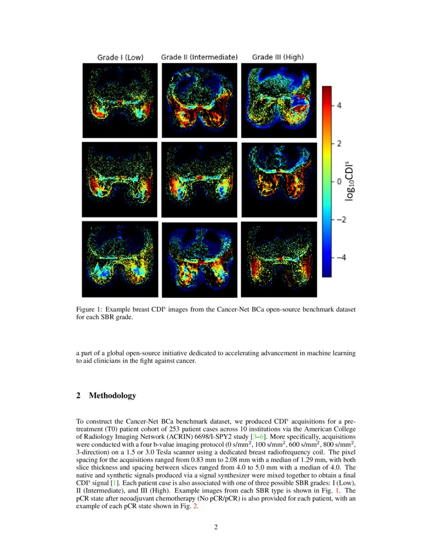 A Multi-Institutional Open-Source Benchmark Dataset for Breast Cancer ...