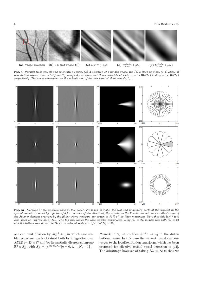 A Multi Orientation Analysis Approach To Retinal Vessel Tracking Deepai