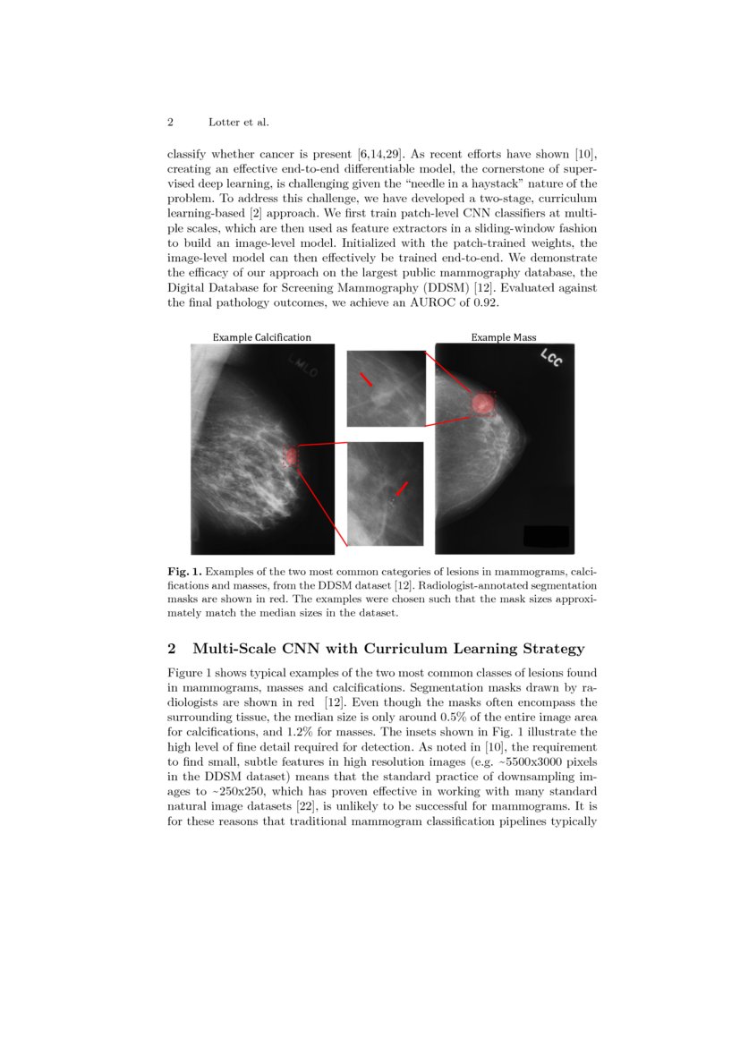 A Multi-Scale CNN and Curriculum Learning Strategy for Mammogram ...
