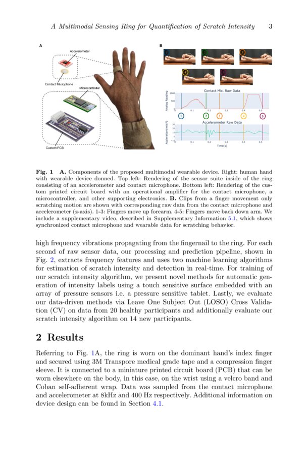 A Multimodal Sensing Ring for Quantification of Scratch Intensity | DeepAI