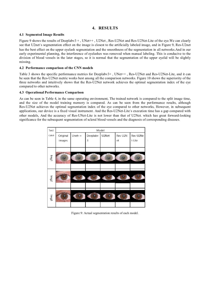 A New Eye Segmentation Method Based On Improved U2net In Tcm Eye Diagnosis Deepai