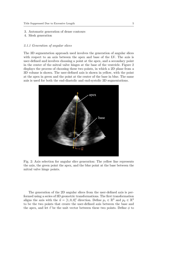 A New Semi Automated Algorithm For Volumetric Segmentation Of The Left