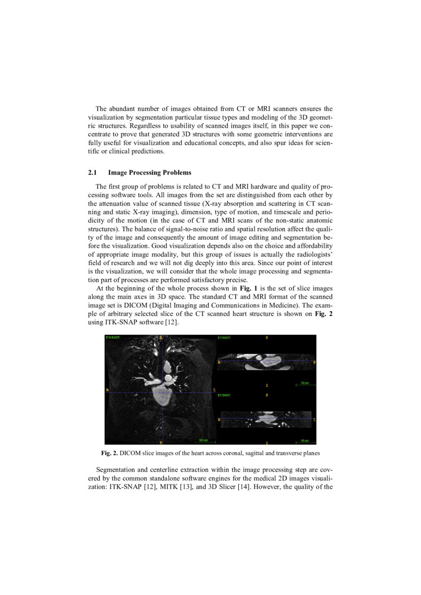 A New Technique of the Virtual Reality Visualization of Complex Volume Images from the Computer ...