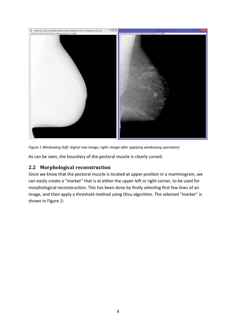 A novel and automatic pectoral muscle identification algorithm for ...