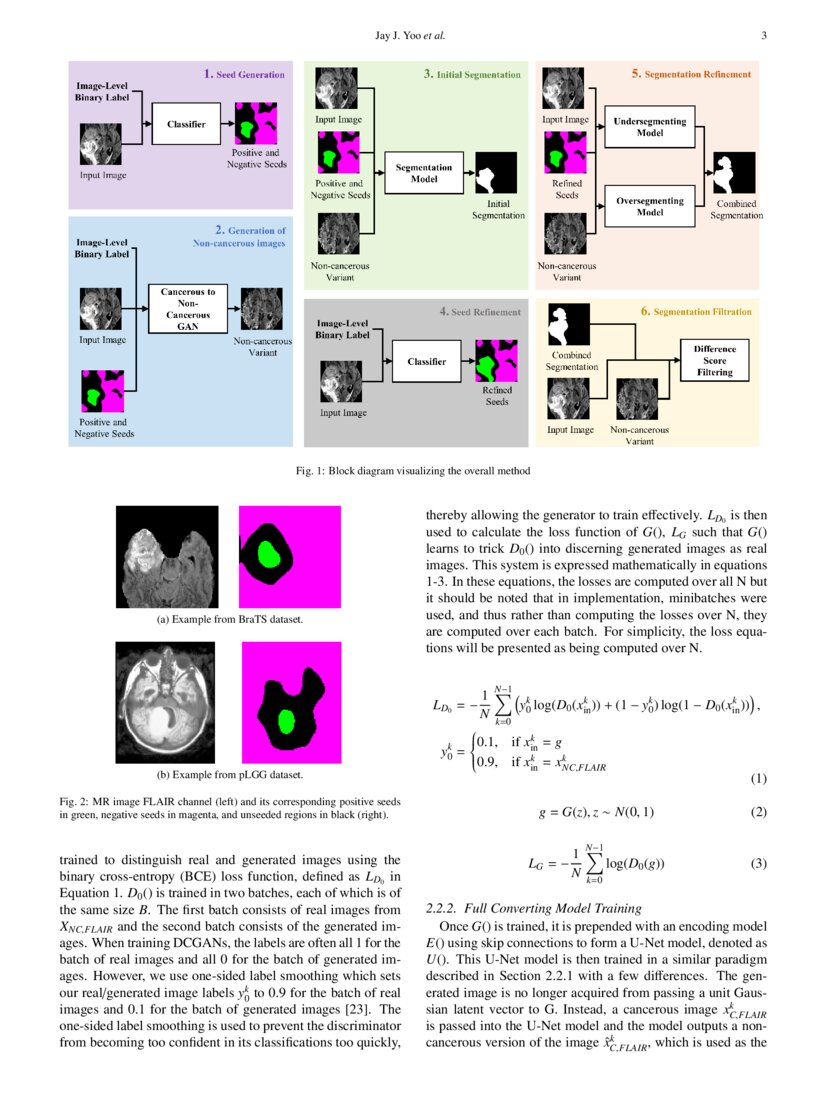 A novel GAN-based paradigm for weakly supervised brain tumor ...
