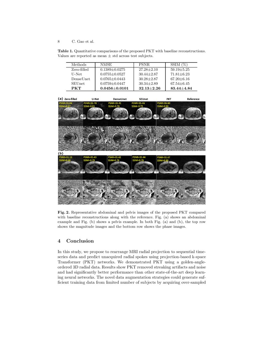 A Projection-Based K-space Transformer Network for Undersampled Radial ...