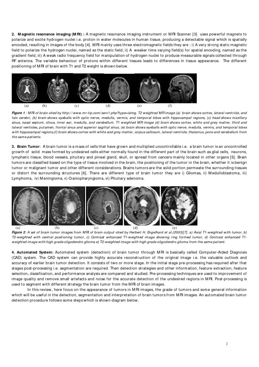 A Review On Automated Brain Tumor Detection And Segmentation From Mri