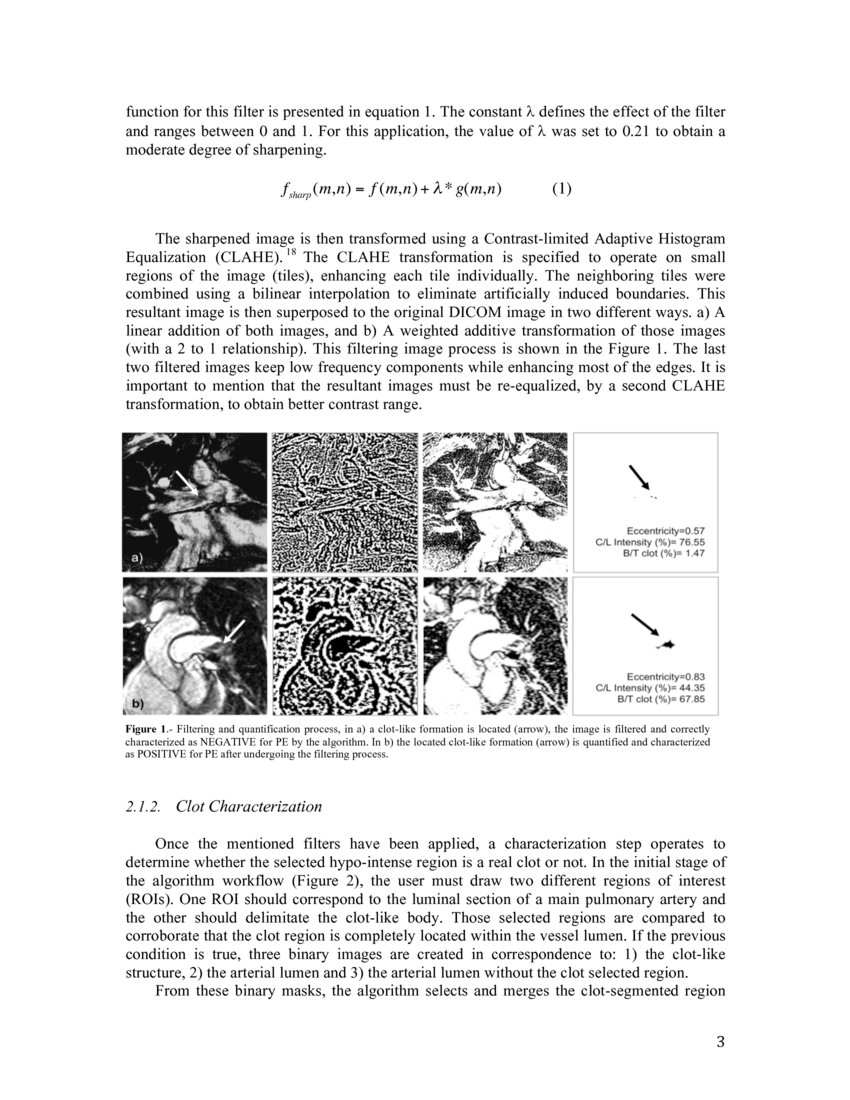 A Semi Automated Segmentation Method For Detection Of Pulmonary