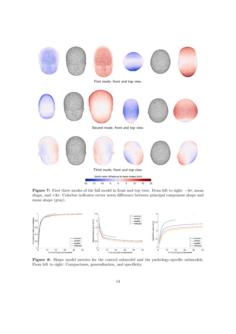 A statistical shape model for radiation-free assessment and classification of craniosynostosis ...