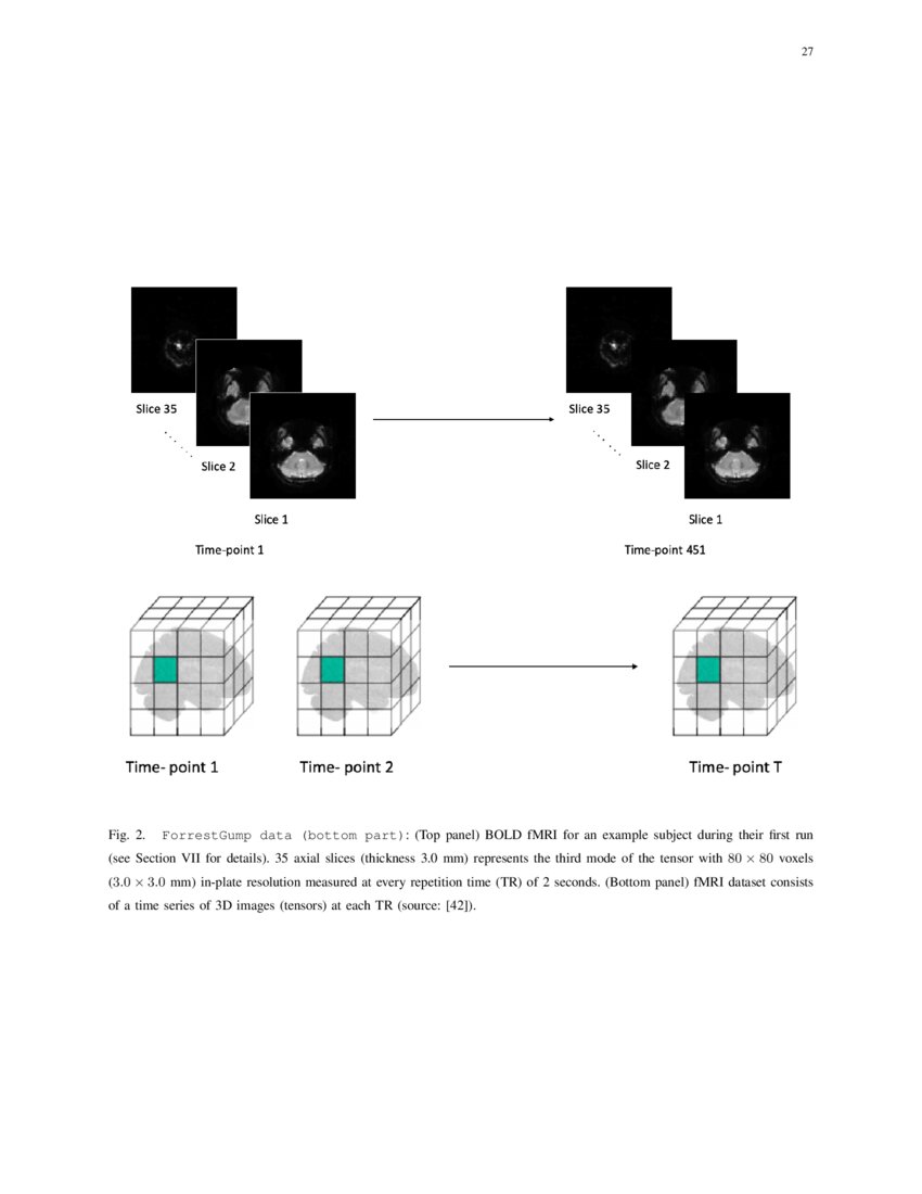 A Tensor Based Varying Coefficient Model For Multi Modal Neuroimaging Data Analysis Deepai