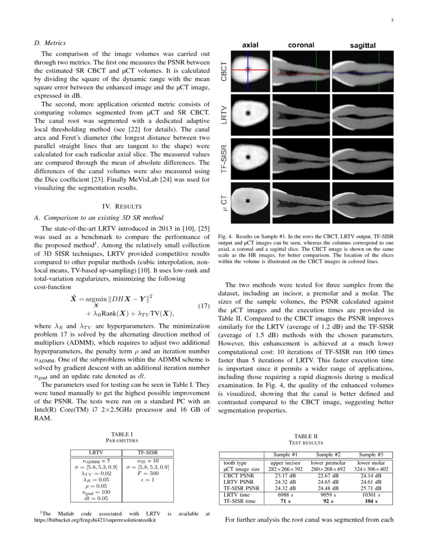 A Tensor Factorization Method For 3d Super Resolution With Application