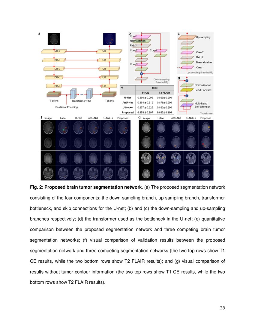 A Transformer Based Deep Learning Approach For Classifying Brain