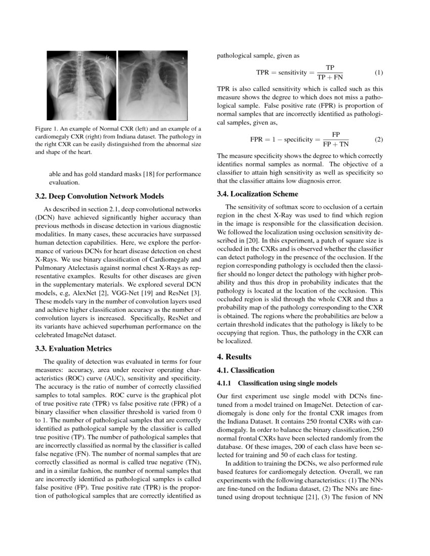 Abnormality Detection And Localization In Chest X Rays Using Deep Convolutional Neural Networks