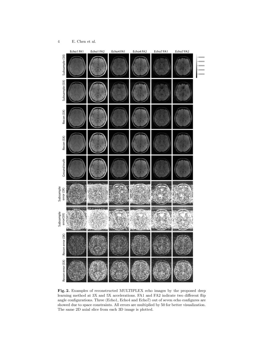 Accelerating 3D MULTIPLEX MRI Reconstruction with Deep Learning | DeepAI