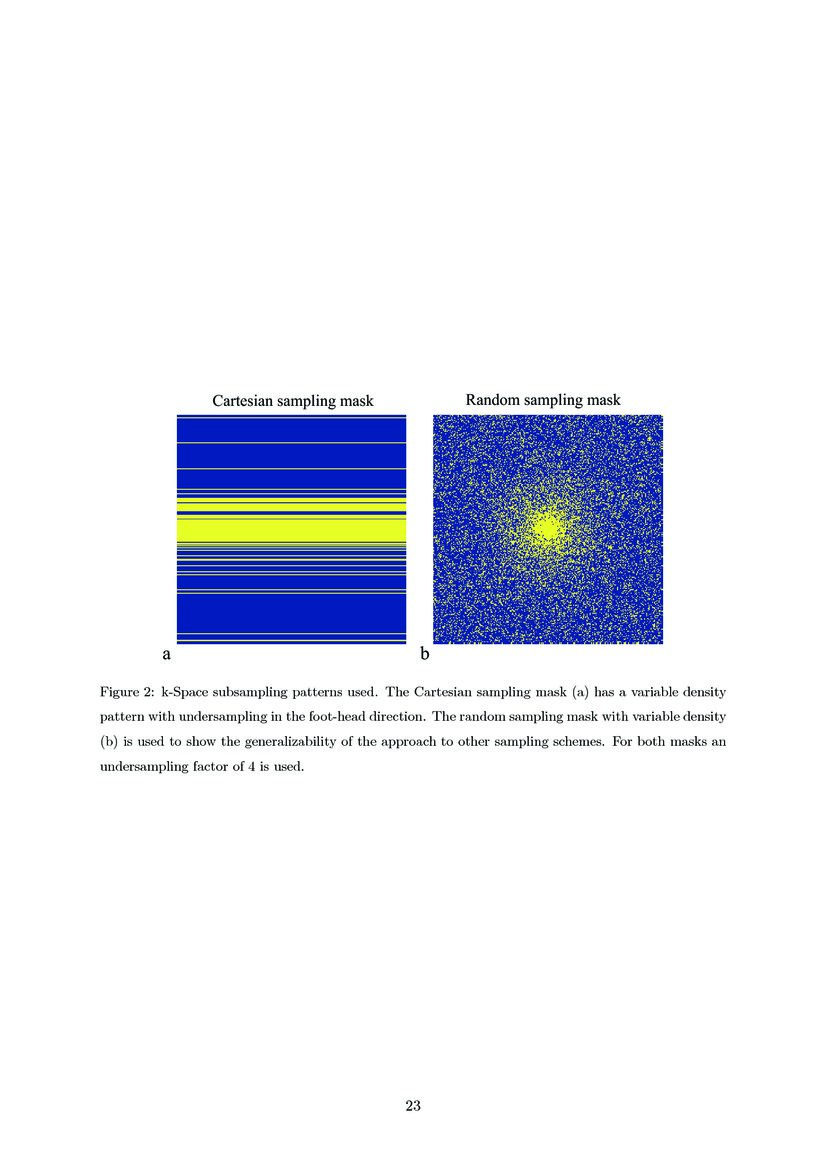 Accelerating Cs In Parallel Imaging Reconstructions Using An Efficient