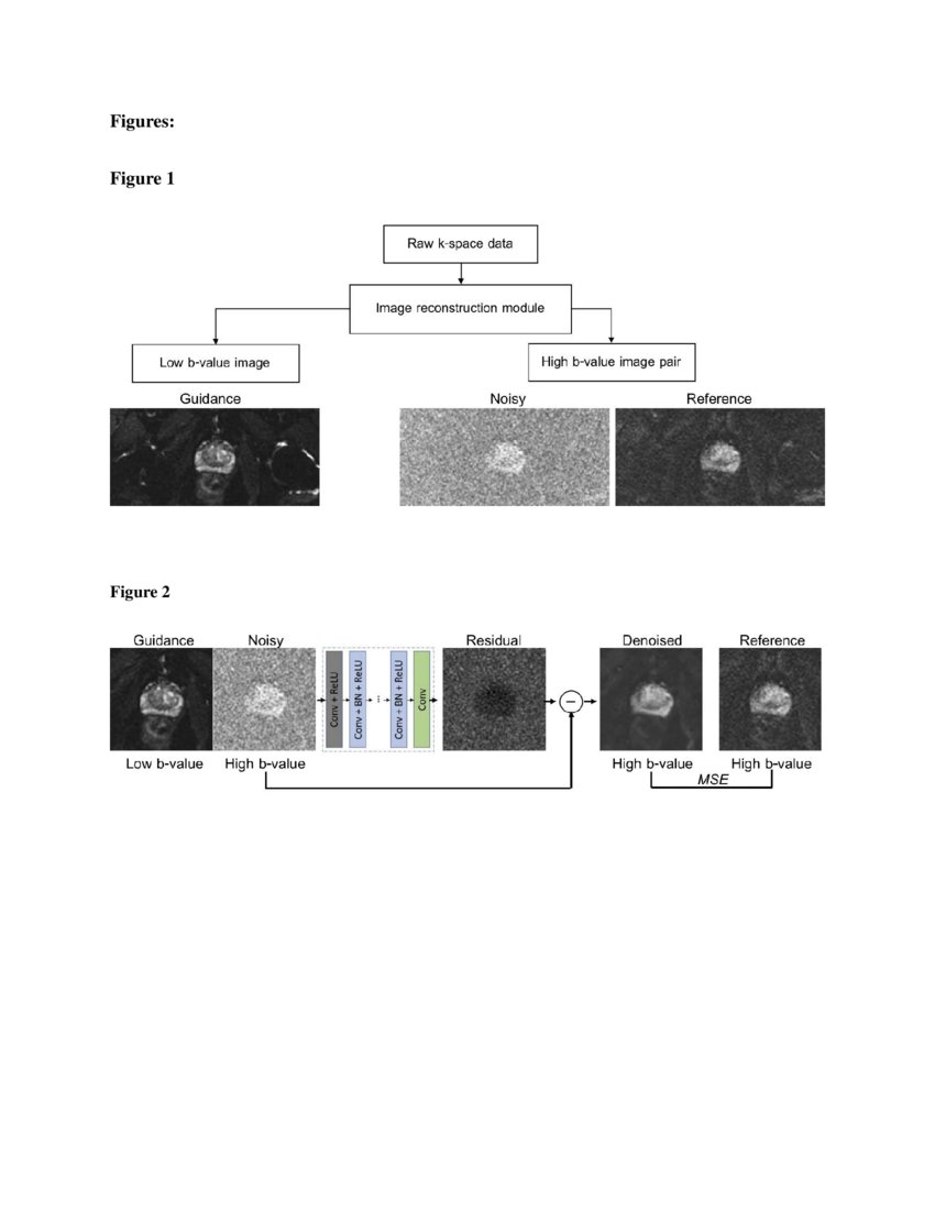 Accelerating Prostate Diffusion Weighted MRI using Guided Denoising Convolutional Neural Network ...