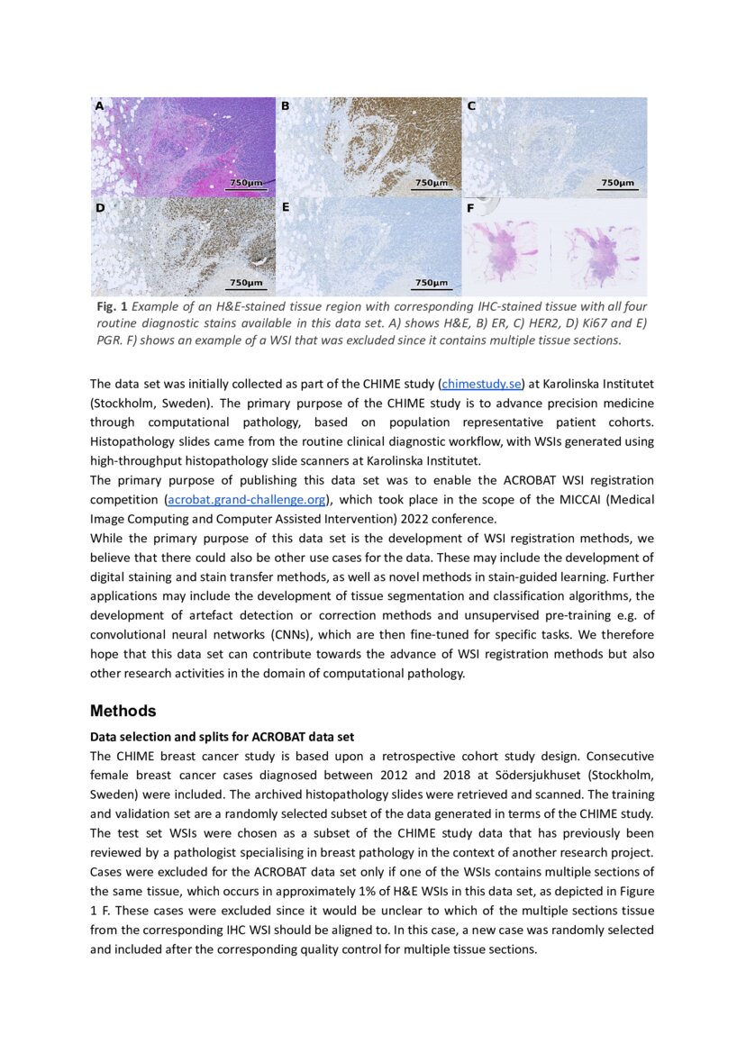 ACROBAT – a multi-stain breast cancer histological whole-slide-image data set from routine ...