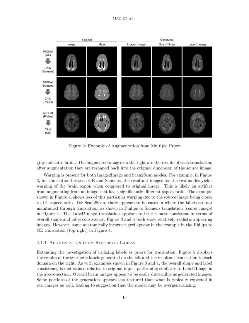 Adapting to Unseen Vendor Domains for MRI Lesion Segmentation | DeepAI