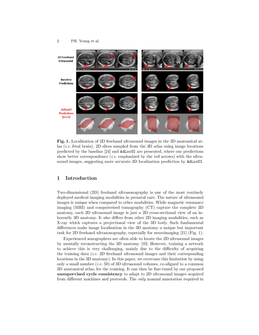 Adaptive 3d Localization Of 2d Freehand Ultrasound Brain Images Deepai