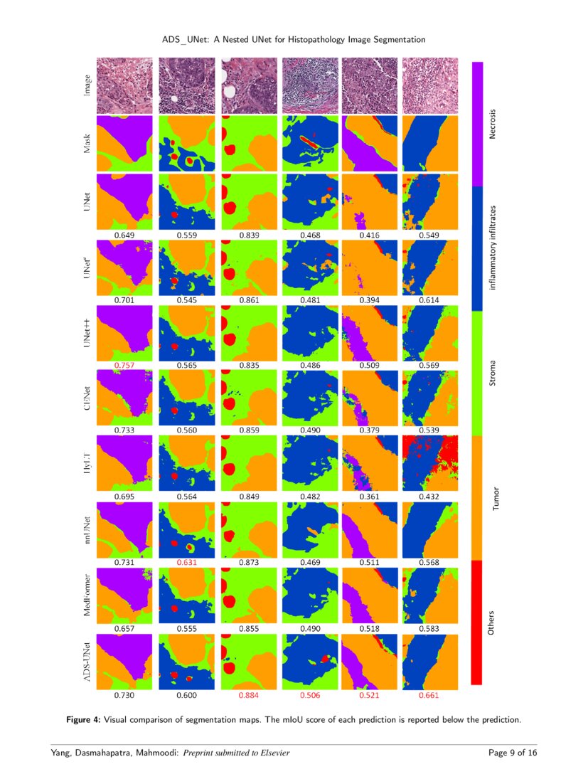 ADS_UNet: A Nested UNet for Histopathology Image Segmentation | DeepAI