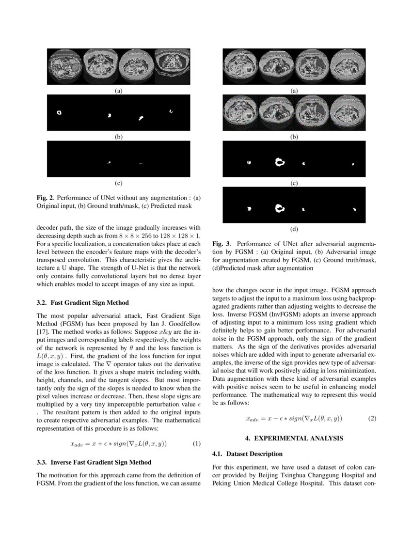 Adversarial Attack Driven Data Augmentation For Accurate And Robust Medical Image Segmentation