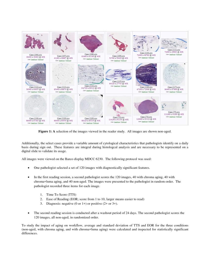 Aging display's effect on interpretation of digital pathology slides ...