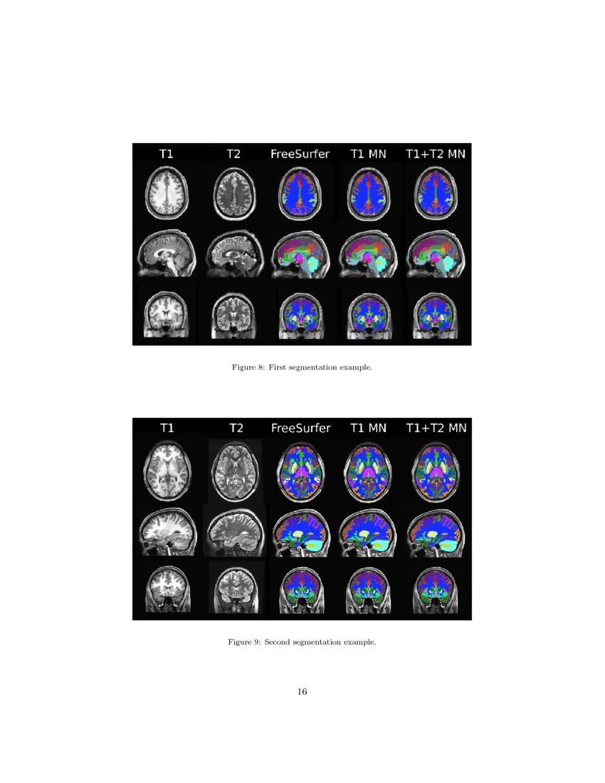 Almost instant brain atlas segmentation for large-scale studies | DeepAI