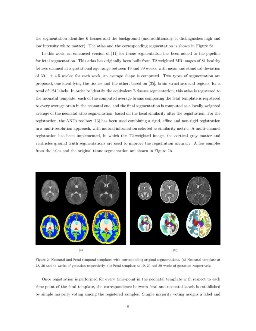 An Automatic Pipeline For Atlas Based Fetal And Neonatal Brain