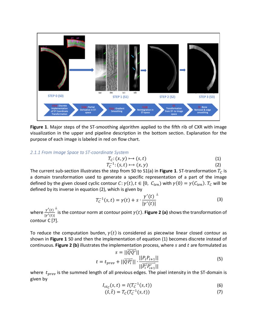 An Efficient and Robust Method for Chest X-Ray Rib Suppression that ...