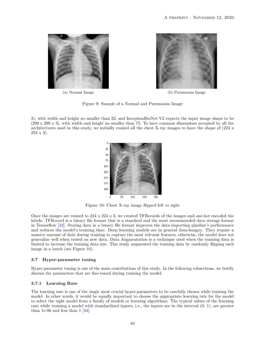 An ensemble-based approach by fine-tuning the deep transfer learning ...