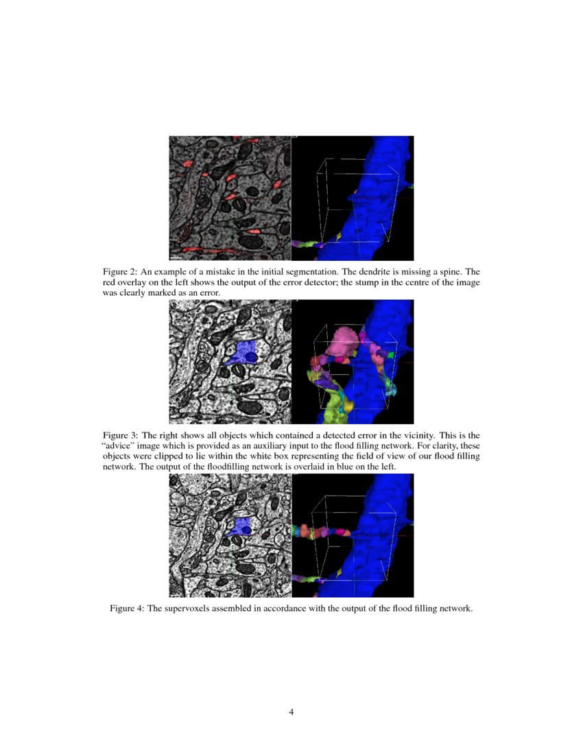 An Error Detection And Correction Framework For Connectomics Deepai