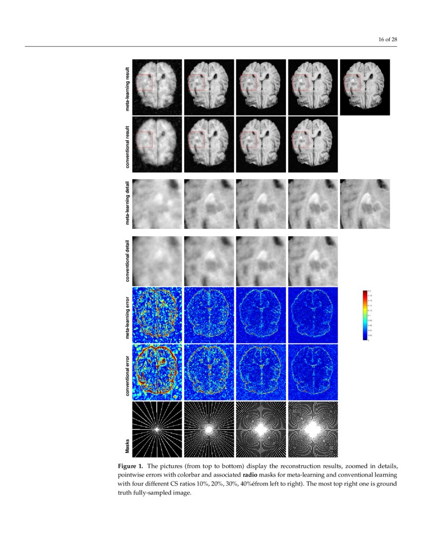 An Optimization-Based Meta-Learning Model for MRI Reconstruction with Diverse Dataset | DeepAI