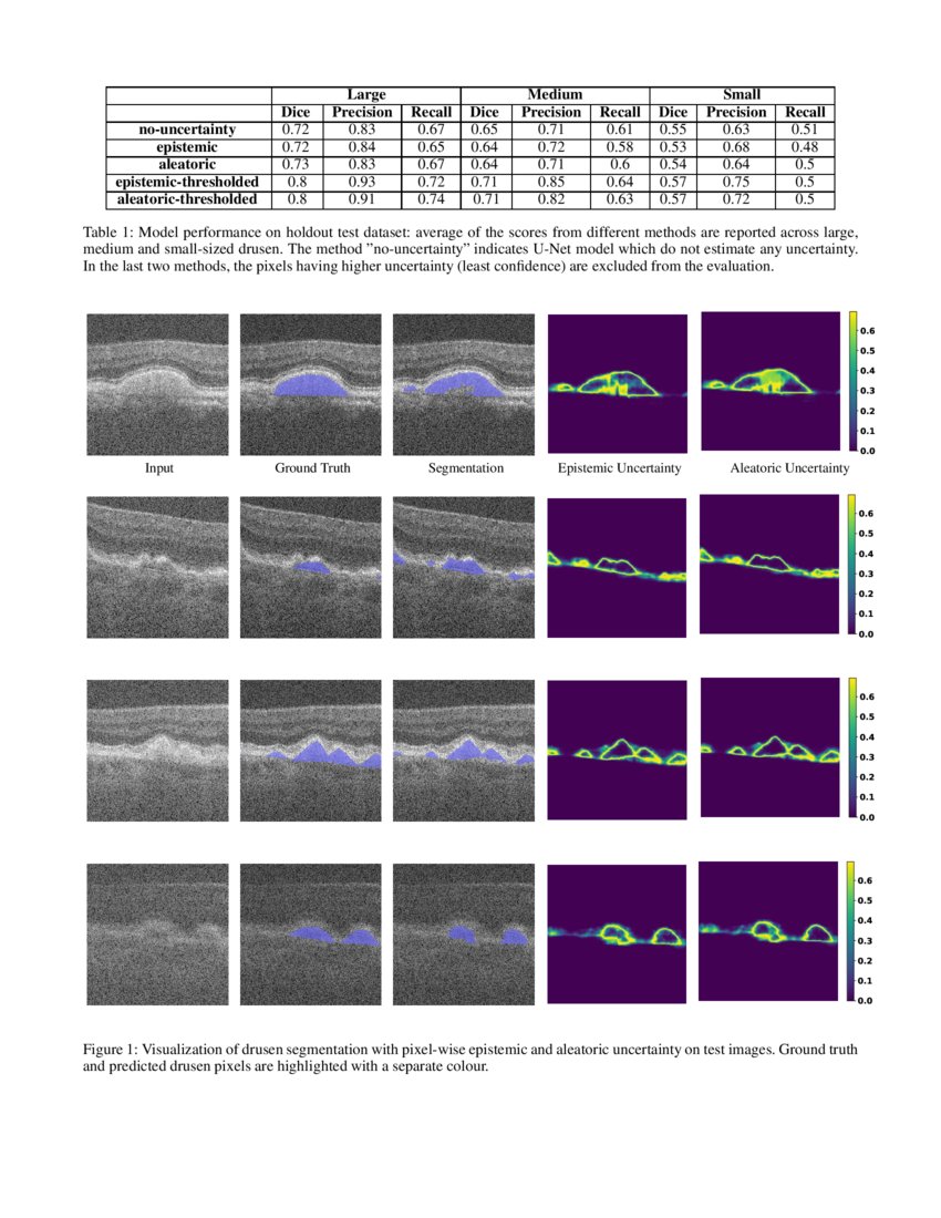 Analyzing Epistemic and Aleatoric Uncertainty for Drusen Segmentation in Optical Coherence ...