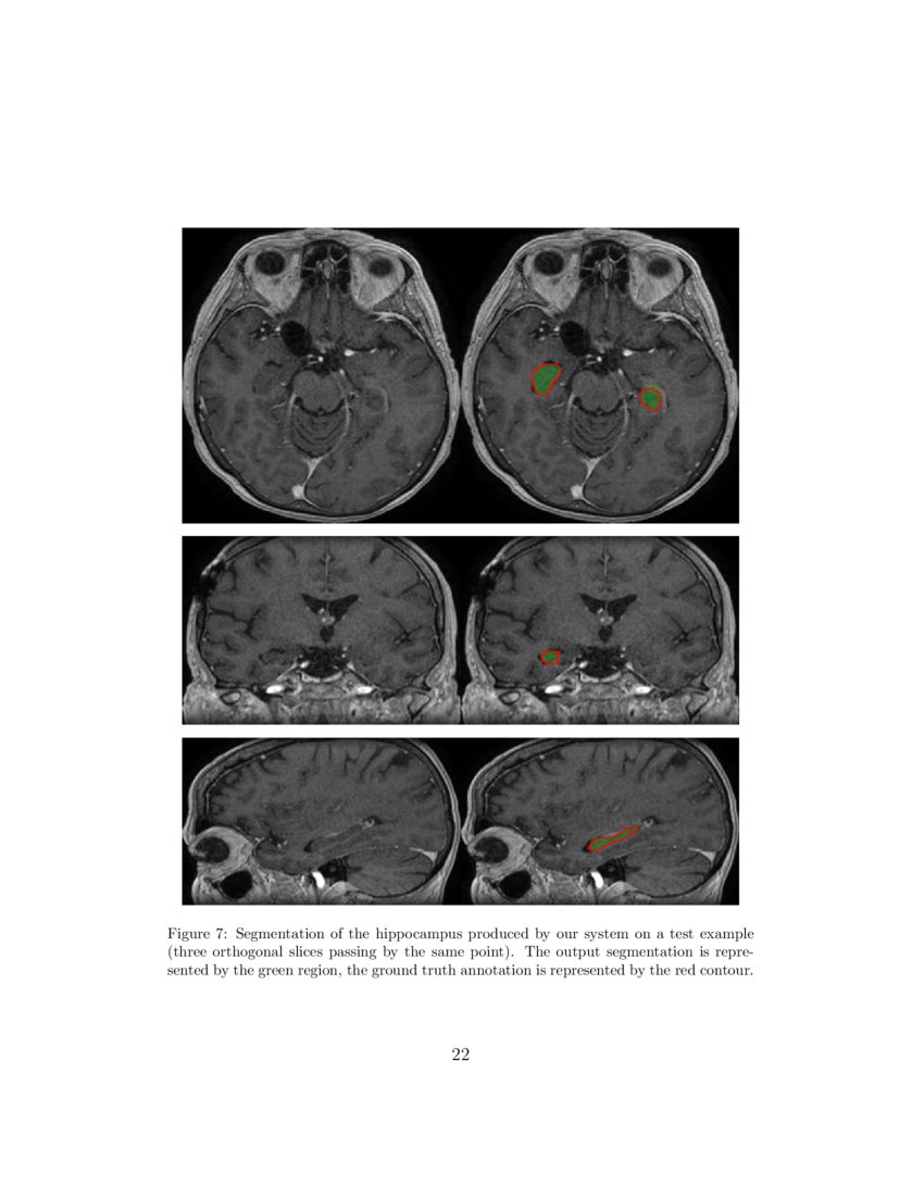 Anatomically Consistent Segmentation of Organs at Risk in MRI with ...