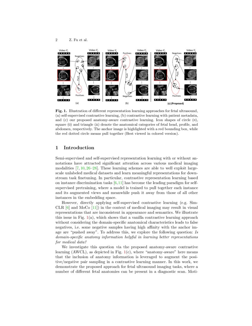 Anatomy-Aware Contrastive Representation Learning for Fetal Ultrasound | DeepAI