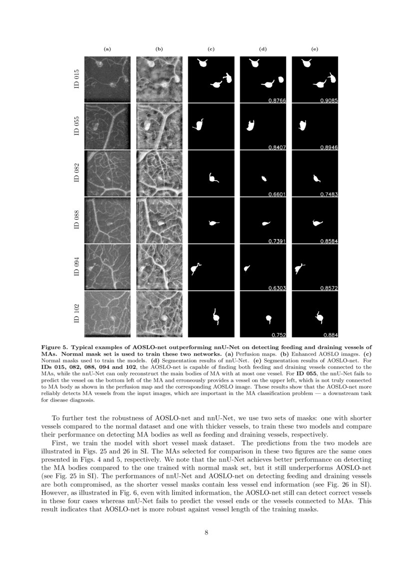 AOSLO-net: A deep learning-based method for automatic segmentation of retinal microaneurysms ...
