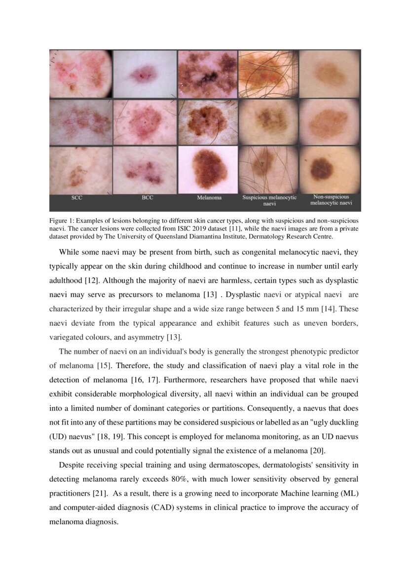 Application of Machine Learning in Melanoma Detection and the ...