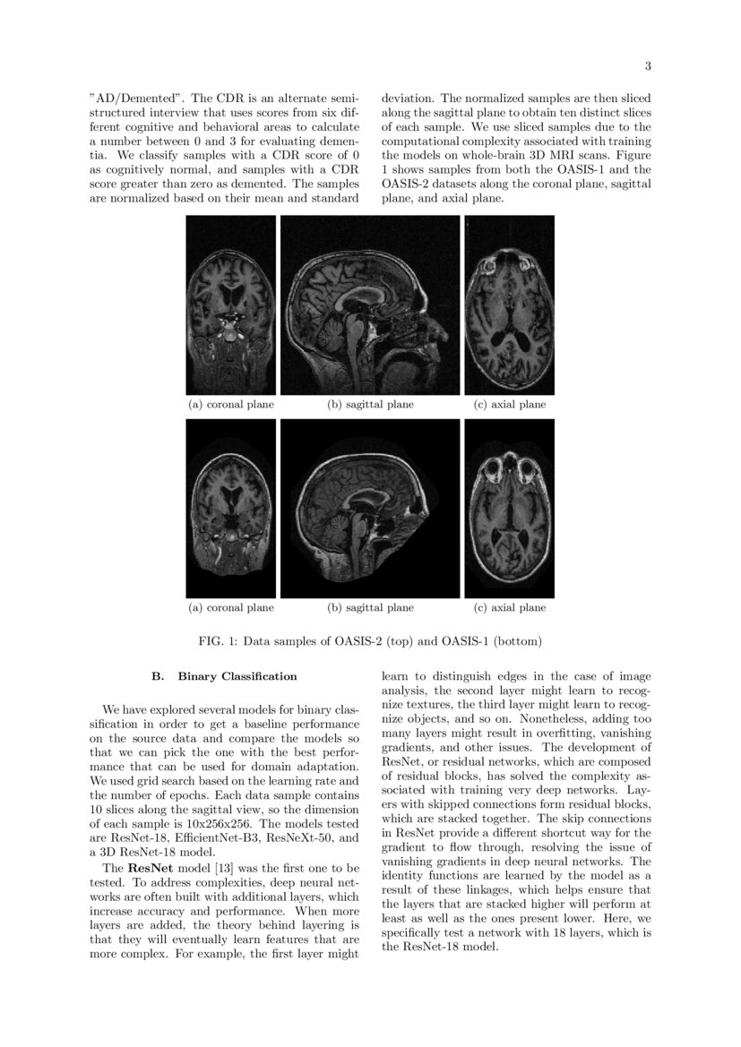 Application of Unsupervised Domain Adaptation for Structural MRI ... Application of Unsupervised Domain Adaptation for Structural MRI ...