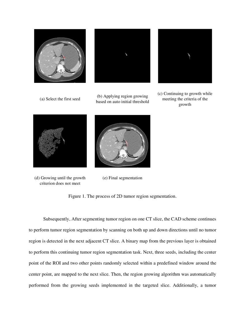 Applying A Random Projection Algorithm To Optimize Machine Learning Model For Predicting 9621