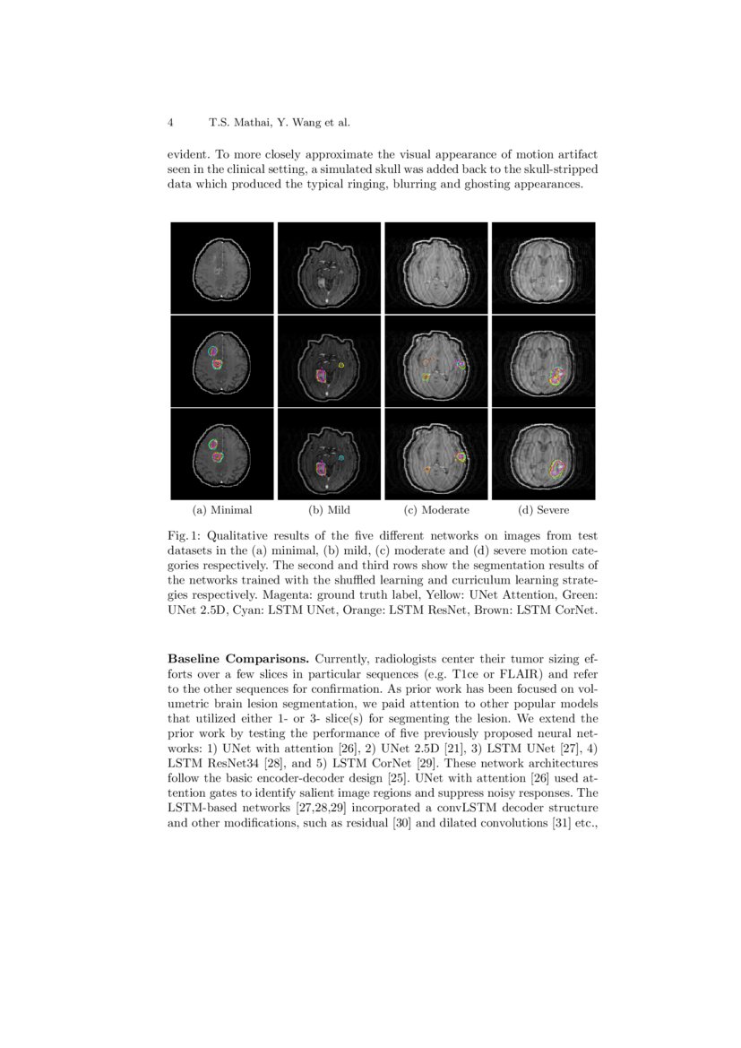 Assessing Lesion Segmentation Bias Of Neural Networks On Motion Corrupted Brain Mri Deepai